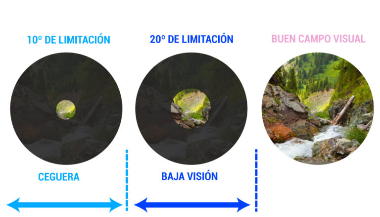 'BAJA VISIÓN' - Tu Optometrista